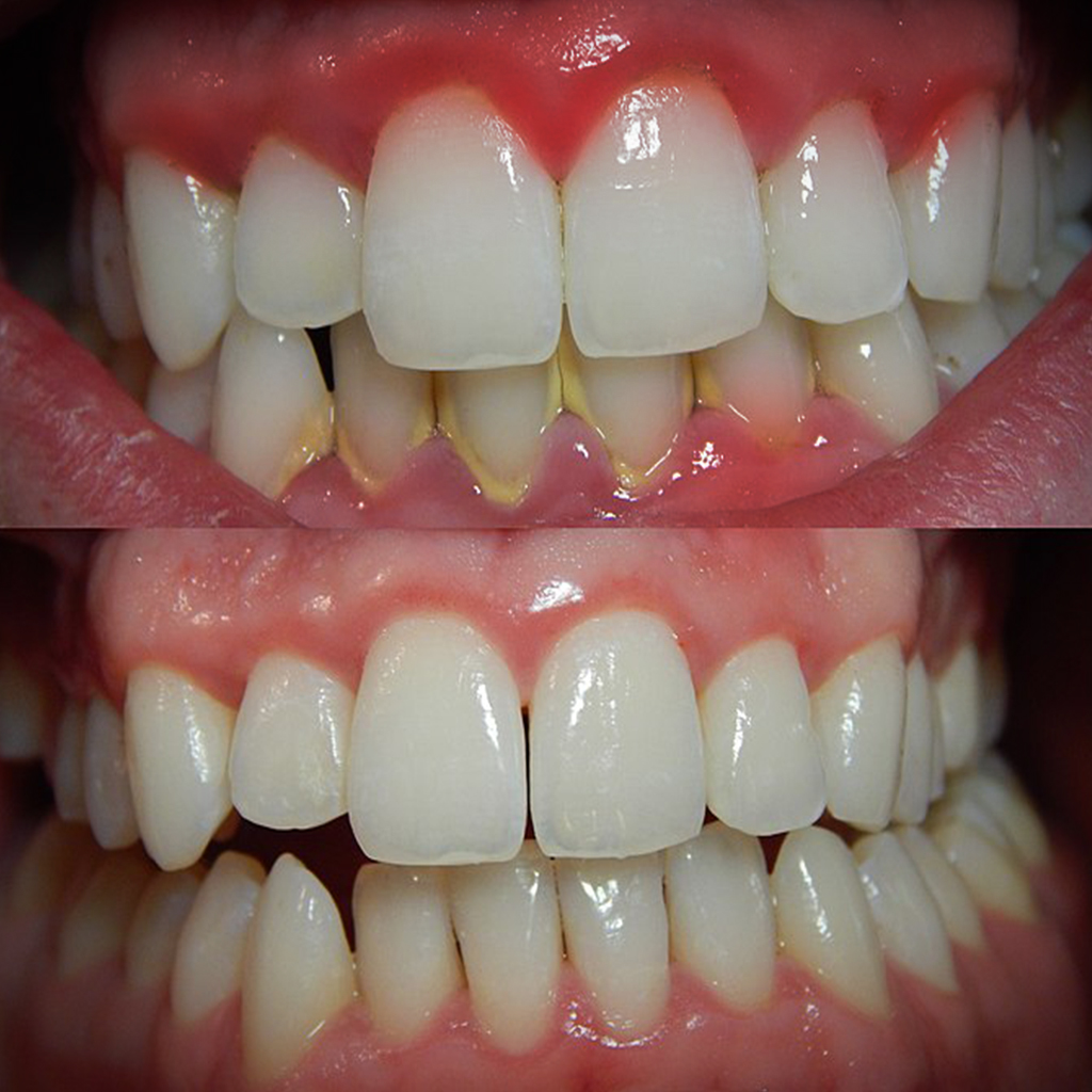 Services - Zen Dental Care